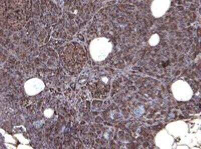 Cholecystokinin-B R/CCKBR Antibody (NB100-2803) by Novus, Part of Bio-Techne