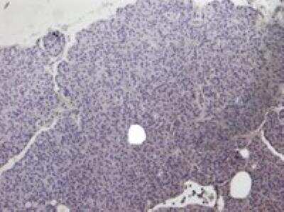 Cholecystokinin-B R/CCKBR Antibody (NB100-2803) by Novus, Part of Bio-Techne