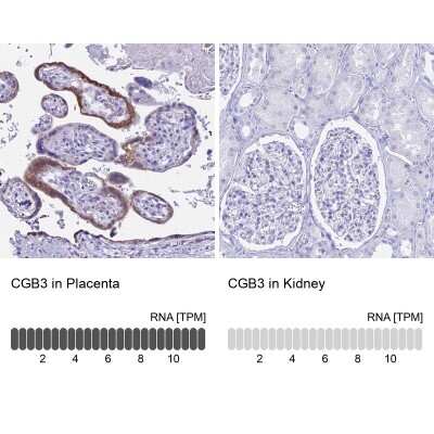 Chorionic Gonadotropin beta Chain (hCG beta) Antibody (NBP2-54685) by ...