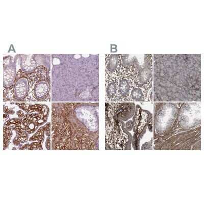 Collagen VI alpha 2 Antibody (NBP2-58879) | Bio-Techne