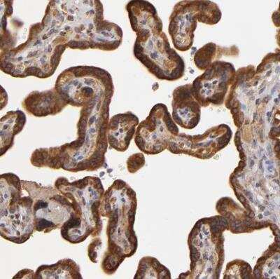 Complement Factor B Antibody (NBP1-89985) by Novus, Part of Bio-Techne