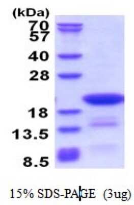 Recombinant Human DTD2 His Protein (NBP2-51523) by Novus, Part of Bio ...