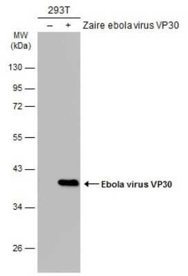 EBOV VP30 protein Products | Bio-Techne