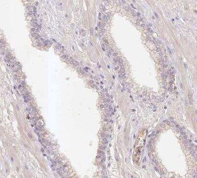 ELL3 Antibody - BSA Free (NBP1-82116) by Novus, Part of Bio-Techne