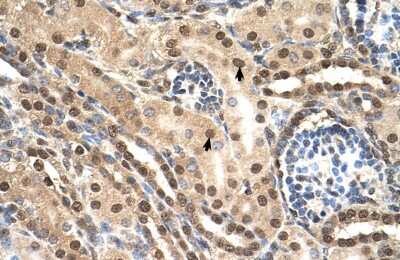 ELOB/ELOC/VHL Complex Antibody (NBP2-82356) by Novus, Part of Bio-Techne