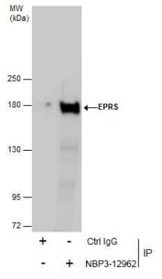 EPRS Antibody - BSA Free (NBP3-12962) by Novus, Part of Bio-Techne