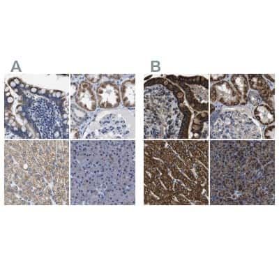 ETFA Antibody - BSA Free (NBP1-84857) by Novus, Part of Bio-Techne
