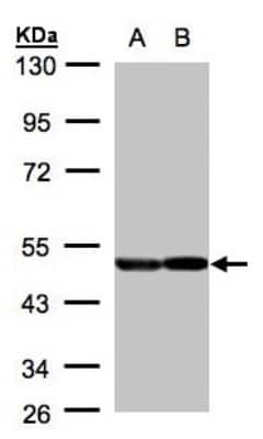 Enolase 2/Neuron-specific Enolase Antibody (NBP1-32090) | Bio-Techne