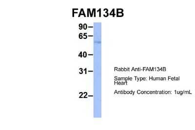 FAM134B Antibody - BSA Free (NBP1-59924) by Novus, Part of Bio-Techne