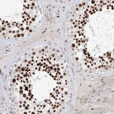 FRMD4A Antibody - BSA Free (NBP1-90807) by Novus, Part of Bio-Techne