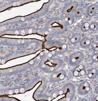 FRYL Antibody - BSA Free (NBP1-94071) by Novus, Part of Bio-Techne