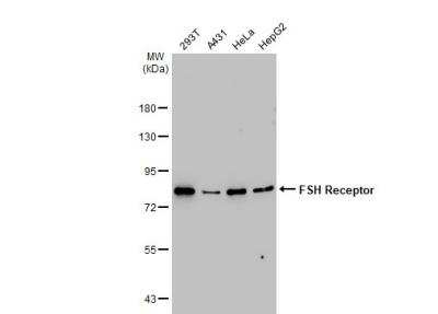 FSHR Antibody (NBP2-16537) by Novus, Part of Bio-Techne