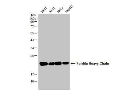 Ferritin Heavy Chain Antibody (NBP1-31944) | Bio-Techne