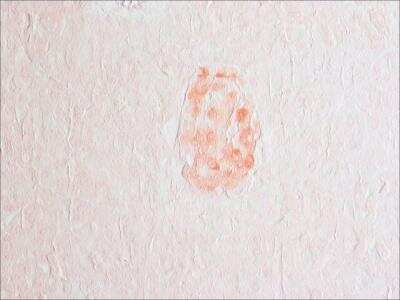 GAD2/GAD65 Antibody (NB110-41528) by Novus, Part of Bio-Techne