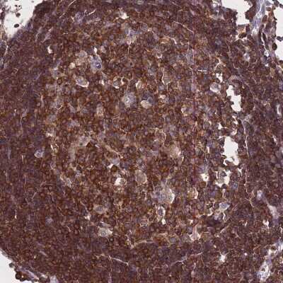 GEM Interacting Protein Antibody - BSA Free (NBP2-30827) by Novus, Part ...