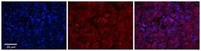 GGCX Antibody - BSA Free (NBP1-59394) by Novus, Part of Bio-Techne