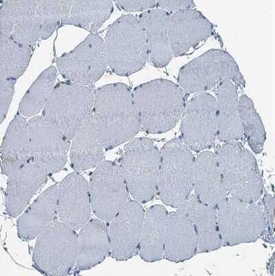 GIF Antibody - BSA Free (NBP1-81611) by Novus, Part of Bio-Techne