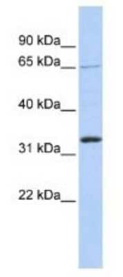 GRHL2 Antibody (NBP1-80369) | Bio-Techne
