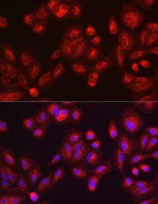 Galactosylceramidase/GALC Antibody - BSA Free (NBP3-03718) | Bio-Techne