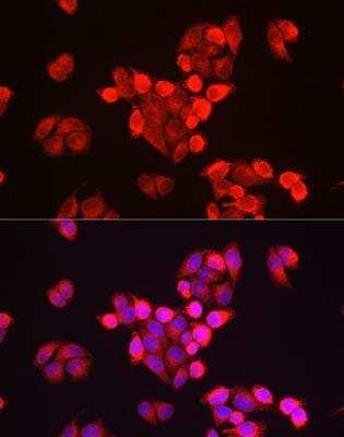 Galactosylceramidase/GALC Antibody - BSA Free (NBP3-03718) | Bio-Techne