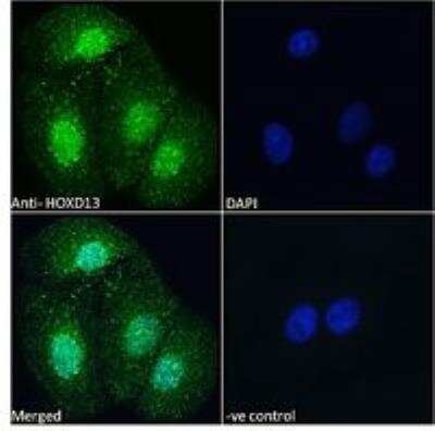 HOXD13 Antibody (NBP2-75091) by Novus, Part of Bio-Techne