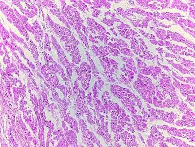 Heart Atrium Products