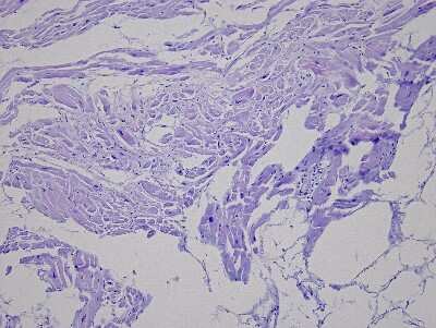 Heart Atrium Products