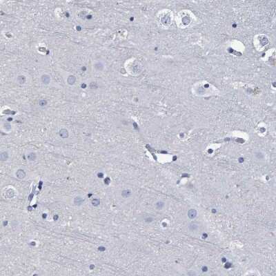 Hemogen Antibody - BSA Free (NBP1-84909) by Novus, Part of Bio-Techne