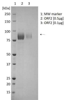 Recombinant Virus Hepatitis E Virus Capsid His (C-Term) Protein (NBP3 ...