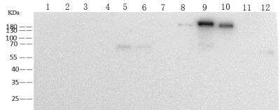 Human Coronavirus Spike Protein Products | Bio-Techne