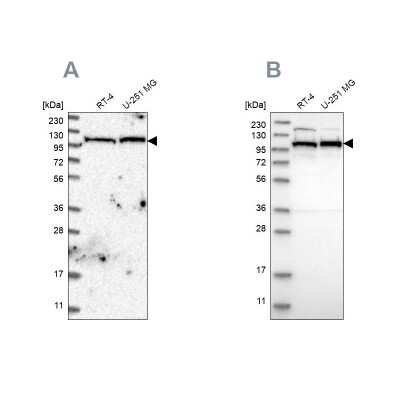 IARS2 Antibody (NBP1-84637) by Novus, Part of Bio-Techne