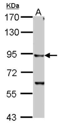 IKK beta Antibody - BSA Free (NBP1-32258) by Novus, Part of Bio-Techne