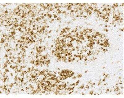 ImmPRESS(TM) HRP Horse anti-Rabbit IgG PLUS Polymer, Peroxidase Kit (MP ...