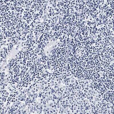 Integrin alpha 2b/CD41 Antibody (NBP1-84581) | Bio-Techne