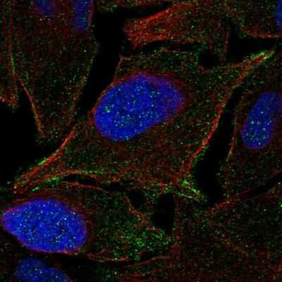JAM-B/VE-JAM Antibody - BSA Free (NBP2-69035) by Novus, Part of Bio-Techne