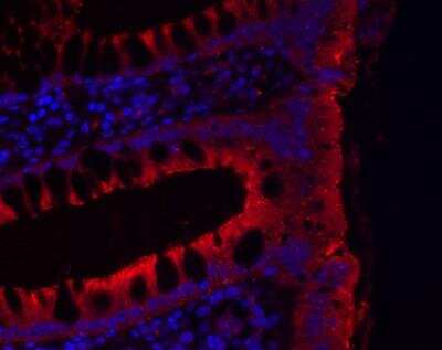 JAM-B/VE-JAM Antibody - BSA Free (NBP1-32655) by Novus, Part of Bio-Techne