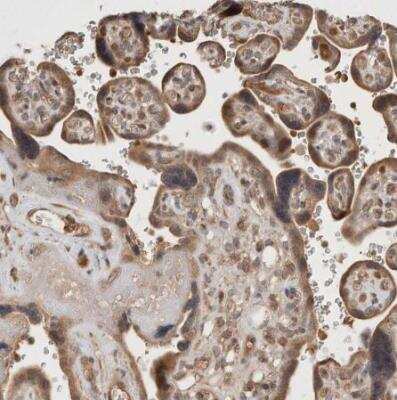 KLHL20 Antibody - BSA Free (NBP1-81559) by Novus, Part of Bio-Techne