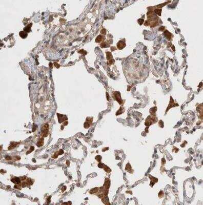 KLHL20 Antibody - BSA Free (NBP1-81559) by Novus, Part of Bio-Techne