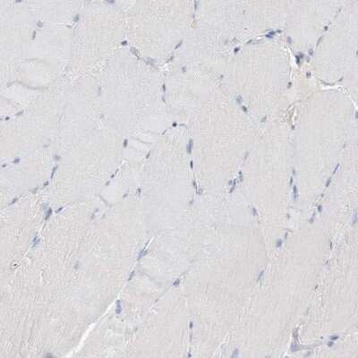 KPRP Antibody - BSA Free (NBP1-90707) by Novus, Part of Bio-Techne