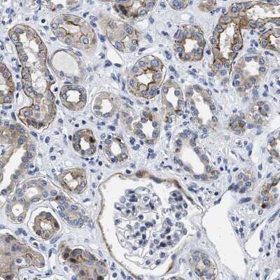 LAD1 Antibody - BSA Free (NBP1-86126) by Novus, Part of Bio-Techne