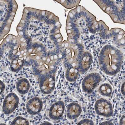 LAD1 Antibody - BSA Free (NBP1-86126) by Novus, Part of Bio-Techne