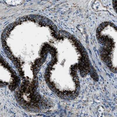 LIMPII/SR-B2 Antibody - BSA Free (NBP1-84583) by Novus, Part of Bio-Techne