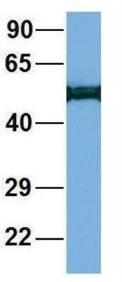 LIV-1/Zip6 Antibody - BSA Free (NBP1-59357) by Novus, Part of Bio-Techne