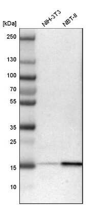 LMW-PTP/ACP1 Antibody - BSA Free (NBP1-89551) by Novus, Part of Bio-Techne