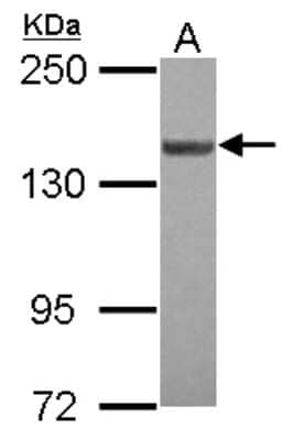LOK Antibody (NBP2-19368) by Novus, Part of Bio-Techne
