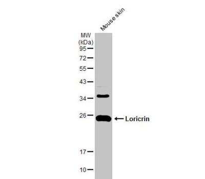 Loricrin Antibody (NBP1-33610) by Novus, Part of Bio-Techne