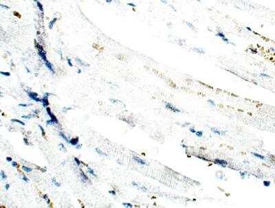 Lymphocyte Expansion Molecule Antibody (NBP3-12323) by Novus, Part of ...