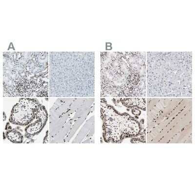 MEF2D Antibody (NBP1-85788) | Bio-Techne