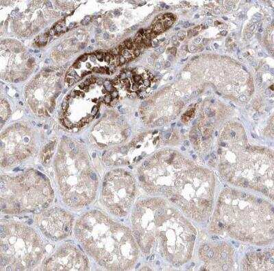 METTL8 Antibody - BSA Free (NBP1-94012) by Novus, Part of Bio-Techne