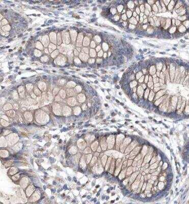 METTL8 Antibody - BSA Free (NBP1-94012) by Novus, Part of Bio-Techne